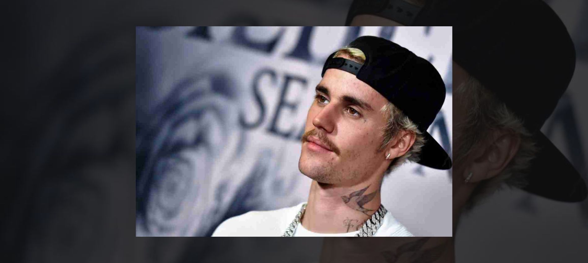 Justin Bieber Injures Hip After One Wheel Accident: Fans React, Family ...